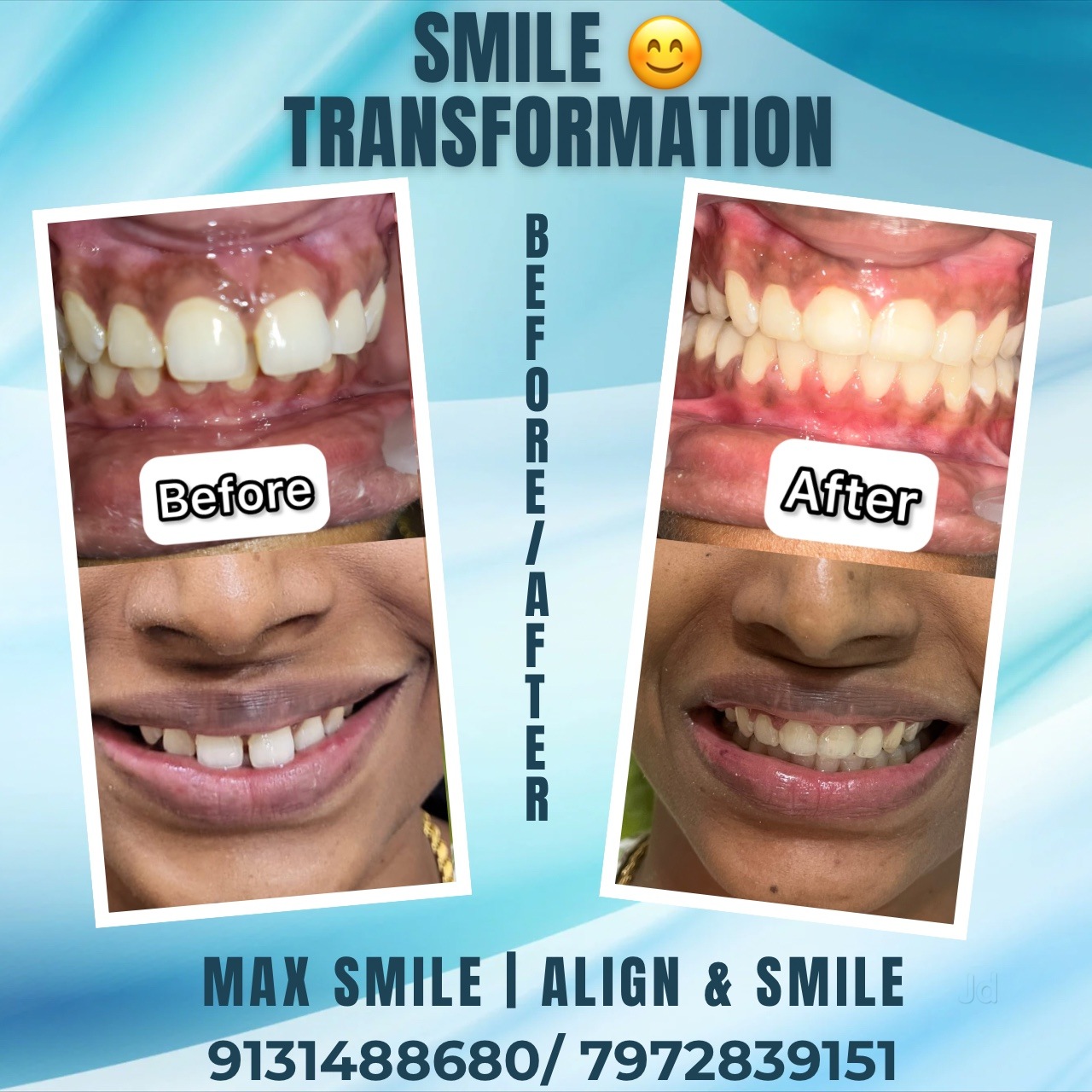 Align and Smile Orthodontic and Multispeciality Dental Clinic in ...