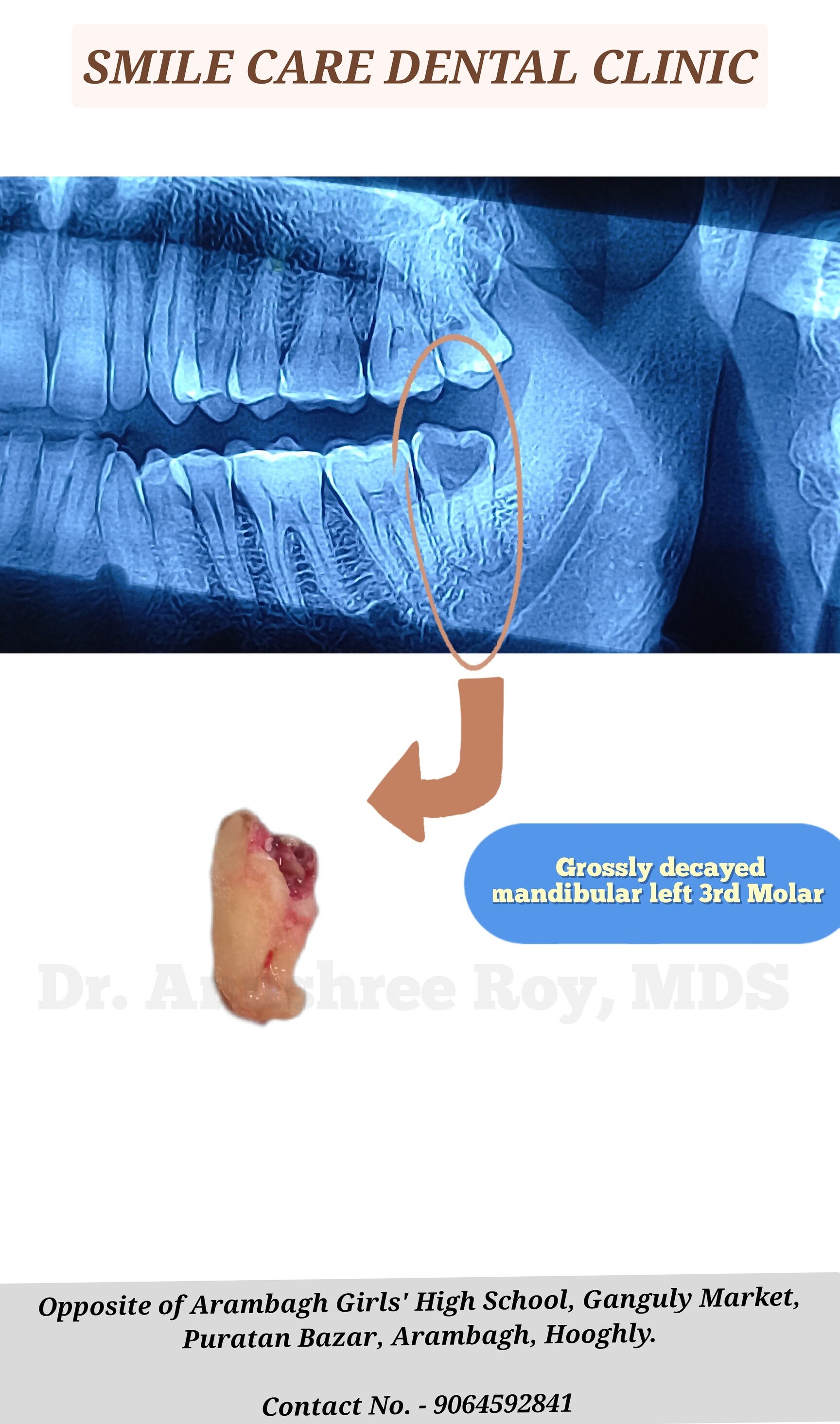 Dr Anushree Roy in Arambagh,Hooghly - Best Dentists near me in Hooghly ...