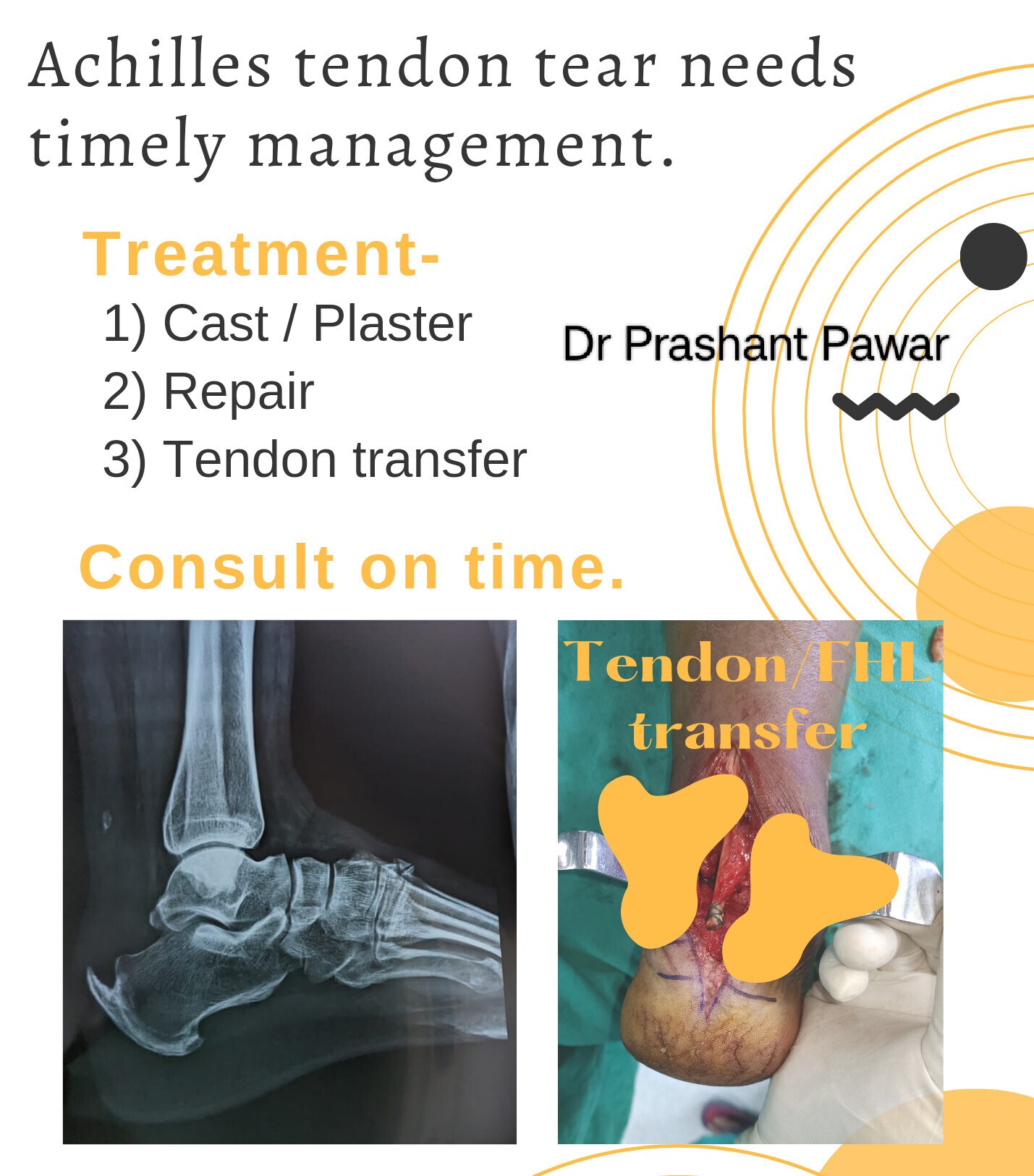 Dr. Pawar - Orthopaedic Clinic in Pimpri,Pune - Best Orthopaedic ...