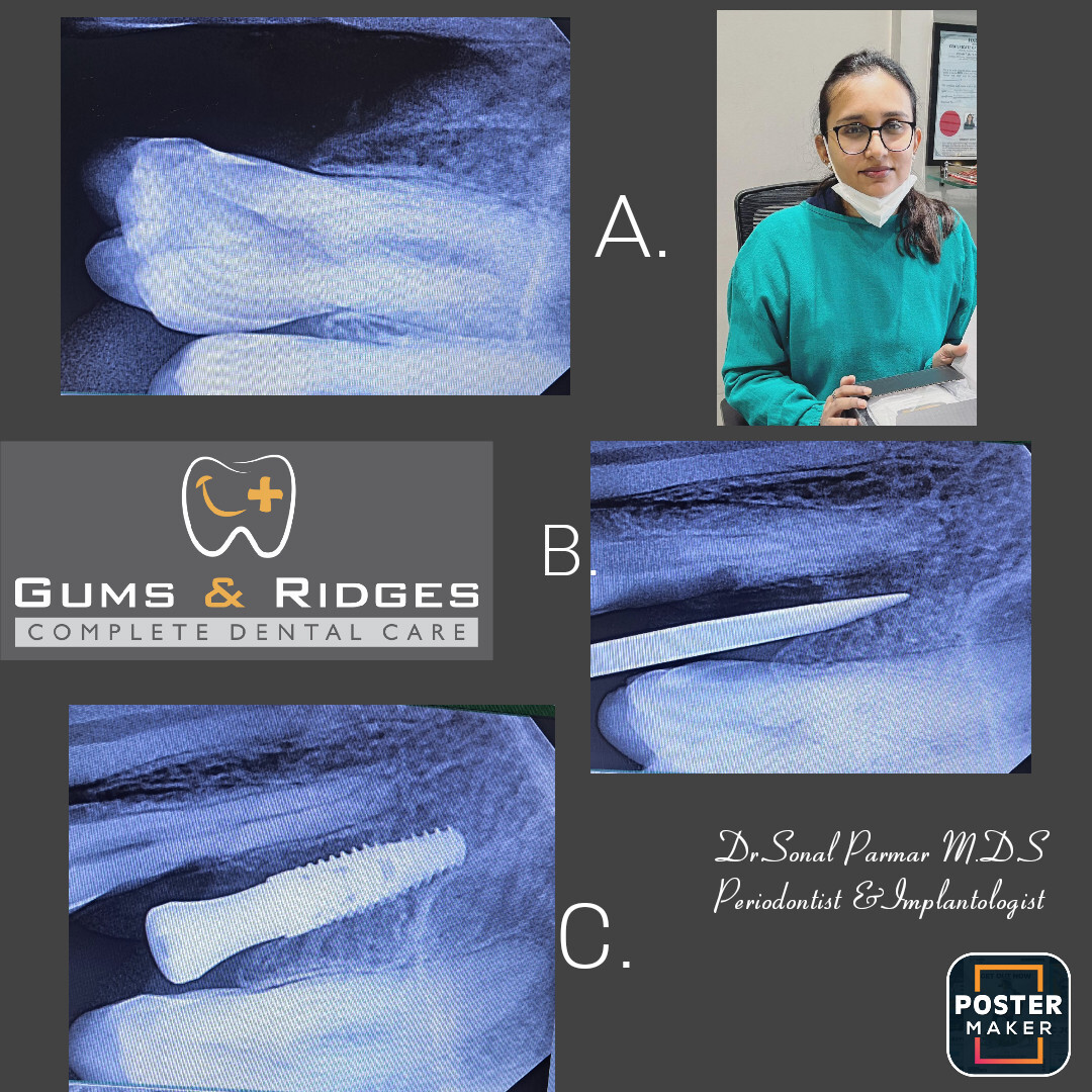 Dr. Sonal Ganji Parmar in New City Light,Surat - Best Dentists near me ...